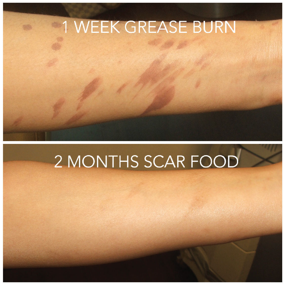 Scar Correct (Best for Scar Tissue Renewal) - Scar Food